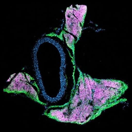 Il grasso beige è amico dei vasi sanguigni, abbassa la pressione - Ansa ...